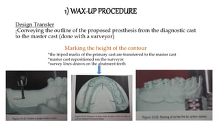 fabrication-of-rpd_compress.pdf dentistry | PPT