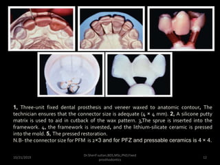 Fabrication tech. all ceramic restorations | PPTX