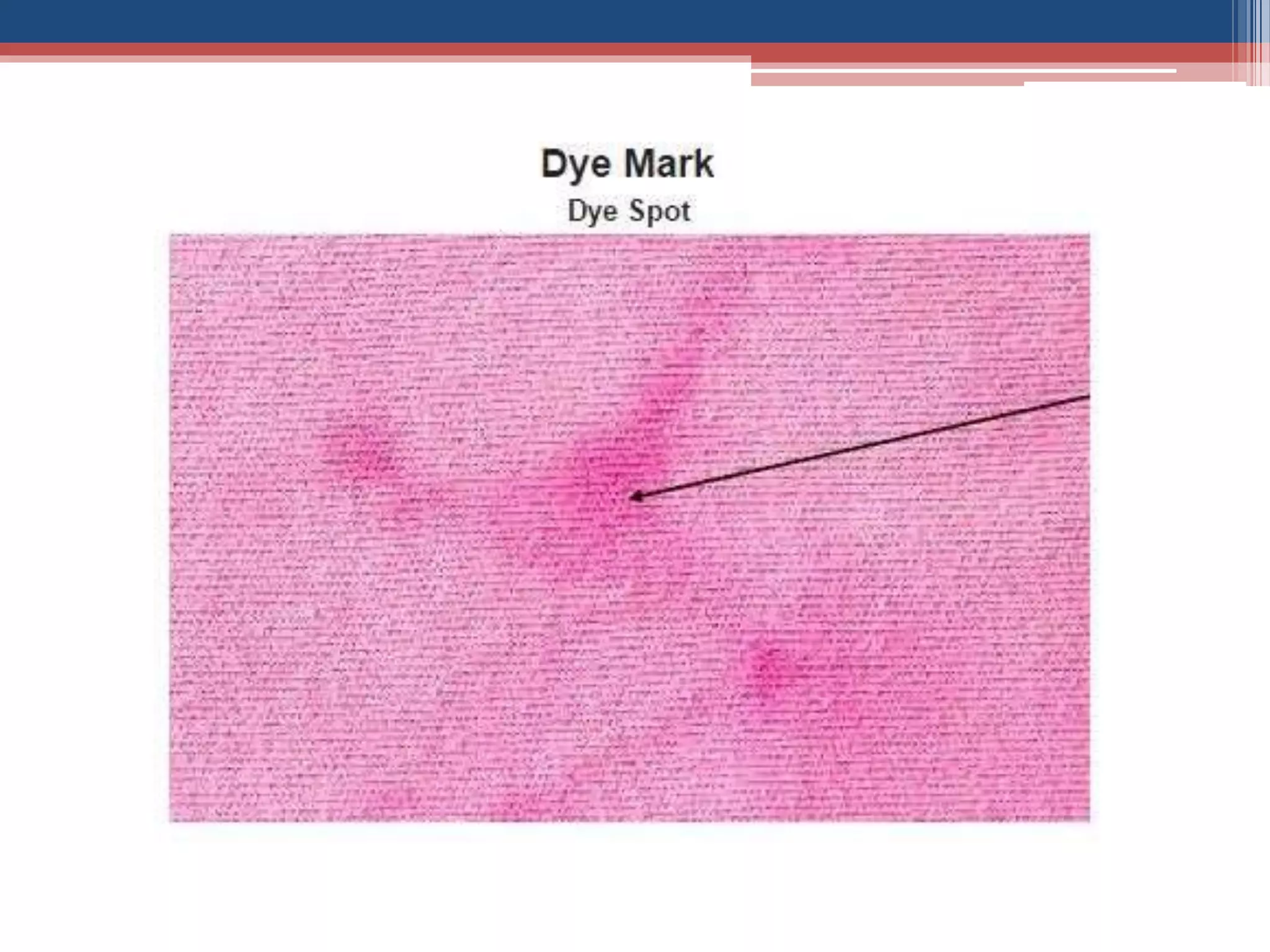 Fabric defects | PPTX