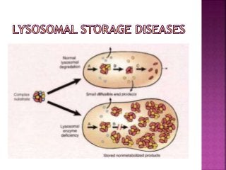 Fabry's Disease | PPTX