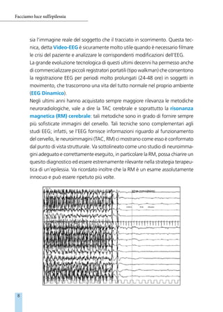 Facciamo luce sull'epilessia | PDF