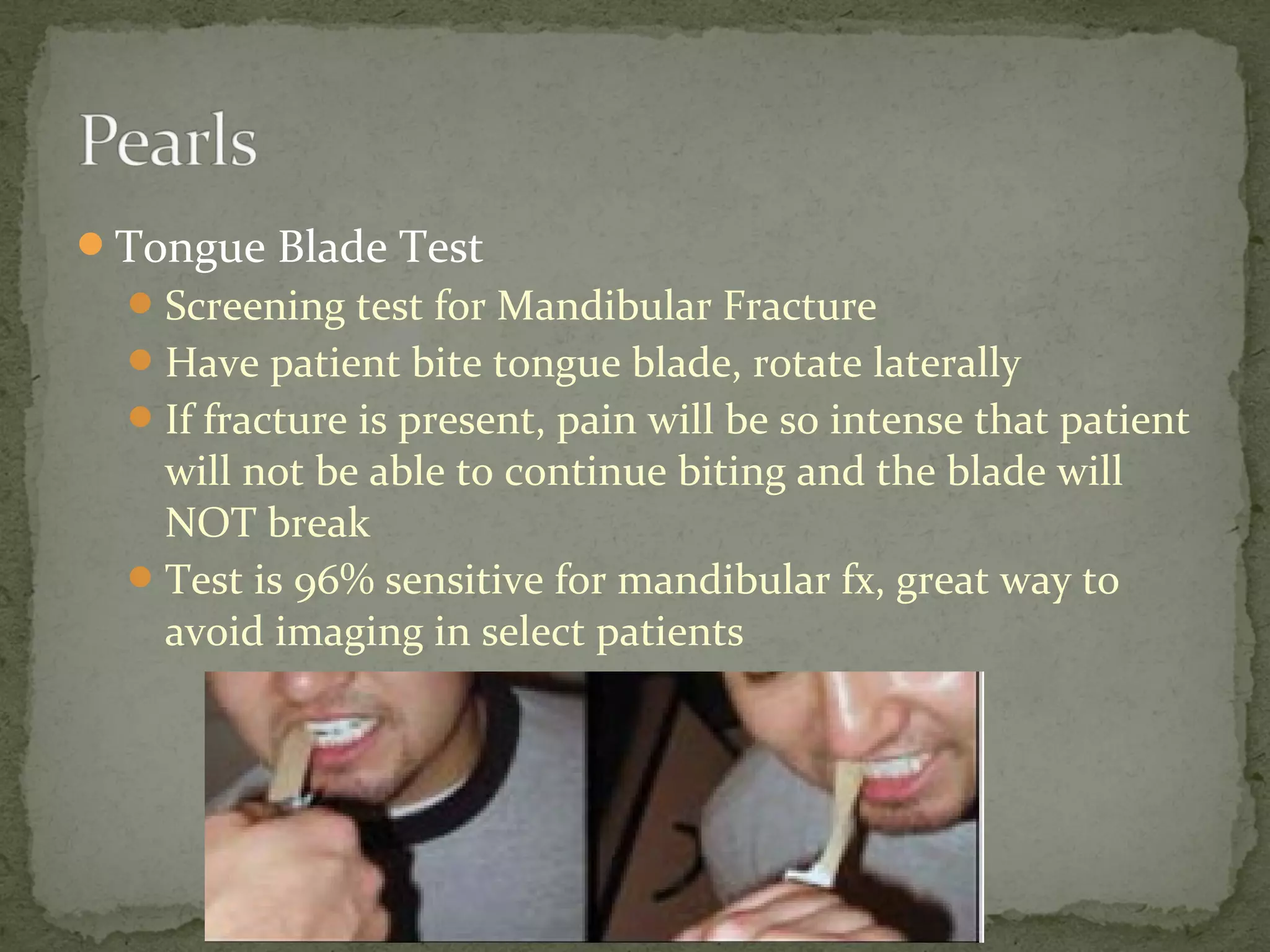 Mandibular Fracture | PPT