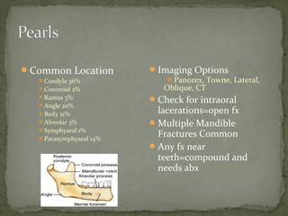 Mandibular Fracture | PPT