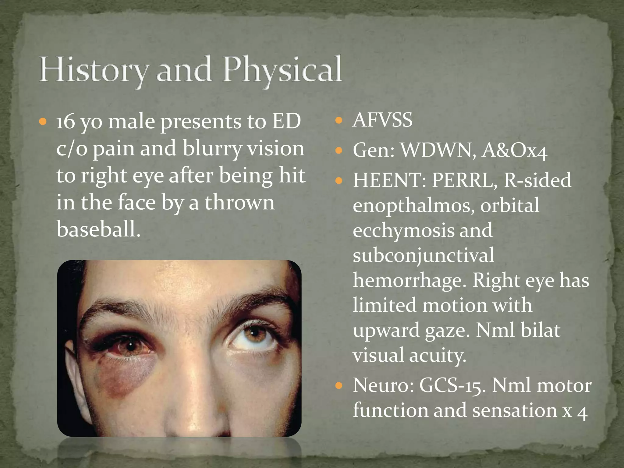Orbital Blowout Fracture | PPTX