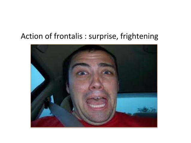 Anatomy- Muscles of Facial expression | PPTX