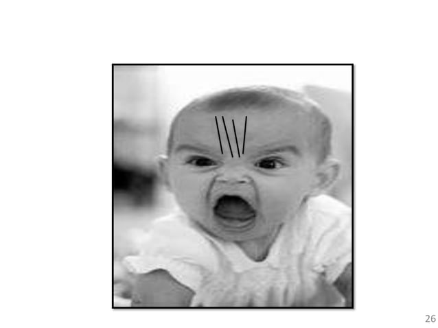 Anatomy- Muscles of Facial expression | PPTX