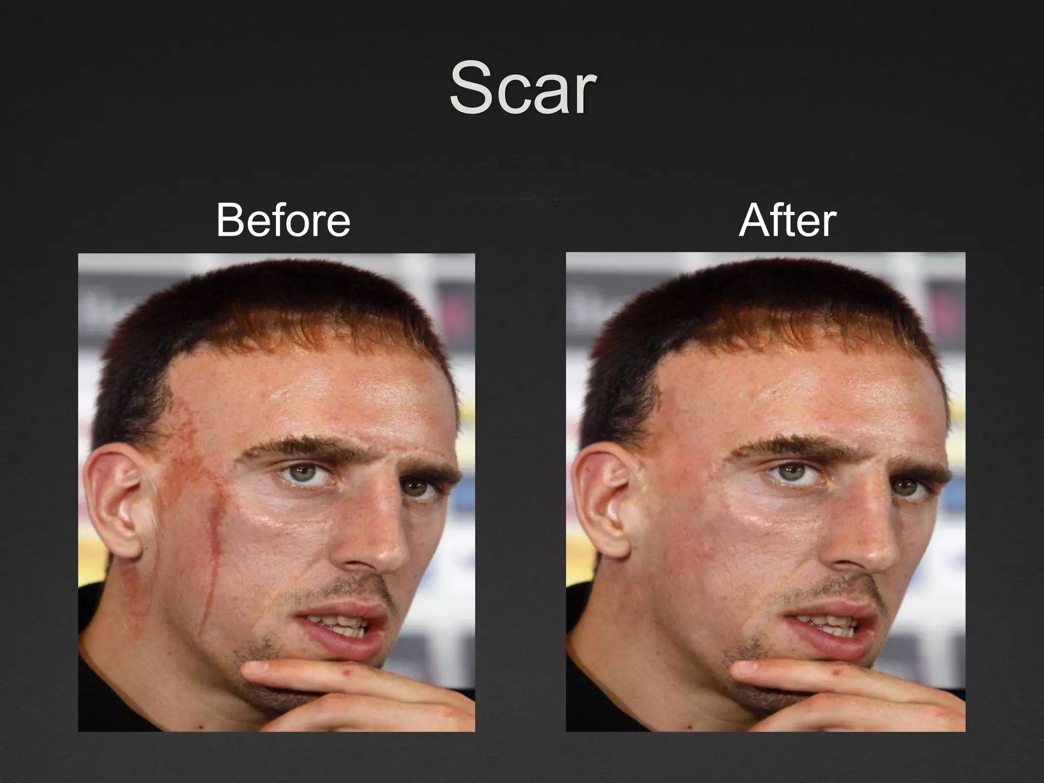 Face blemishes powerpoint | PPTX