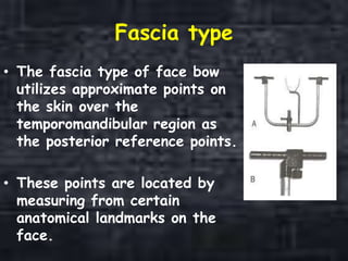 Face bow | PPTX