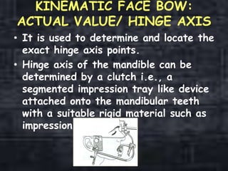 Face bow | PPTX