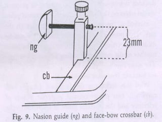 Face bow | PPTX