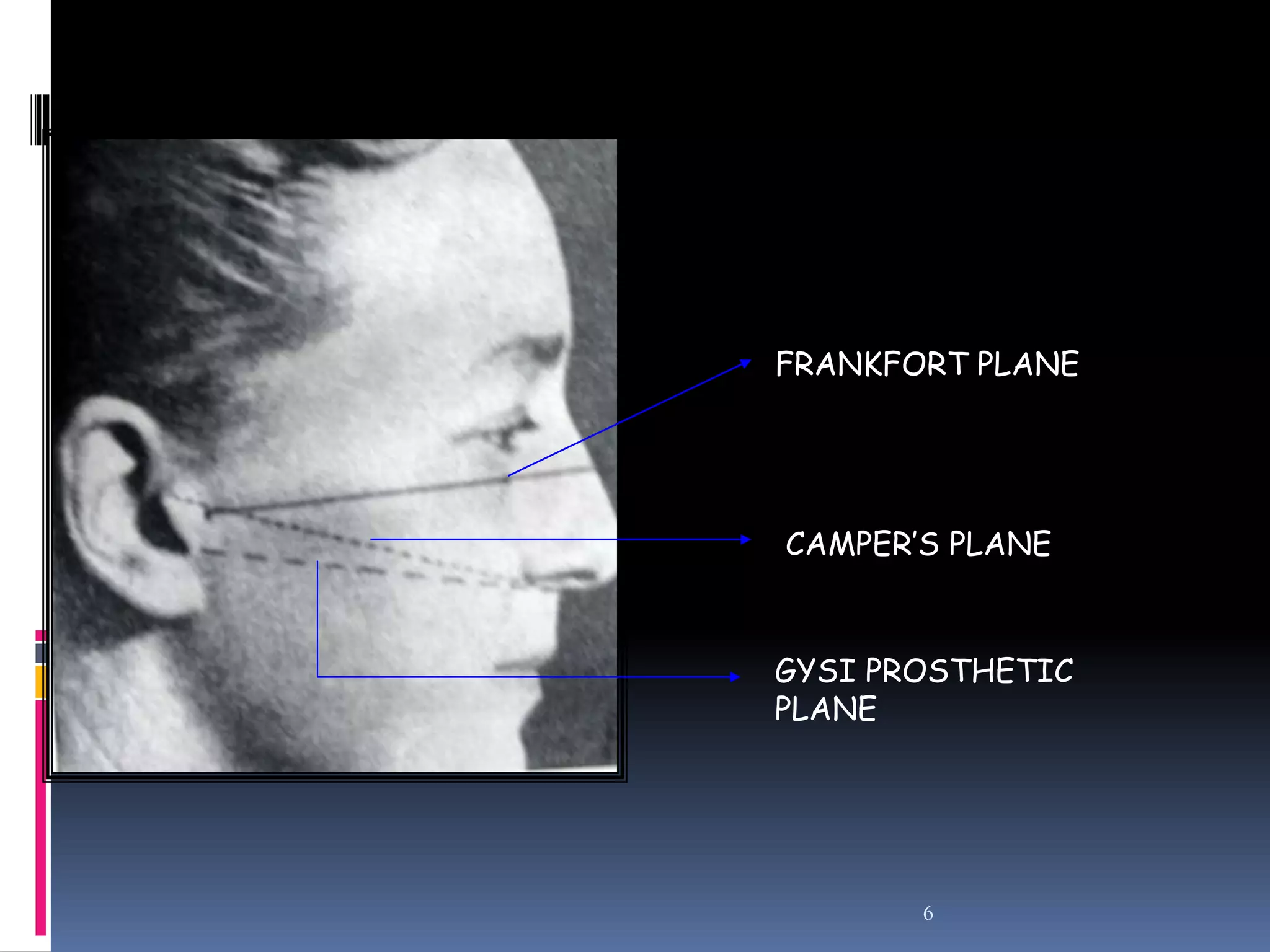 Facebow | PPT