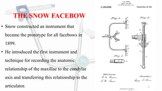 FACEBOW.pptx