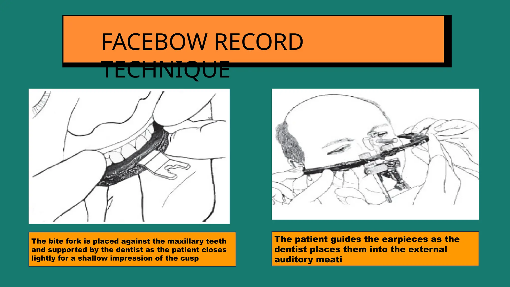 Facebow record, transfer and articulation | PPTX