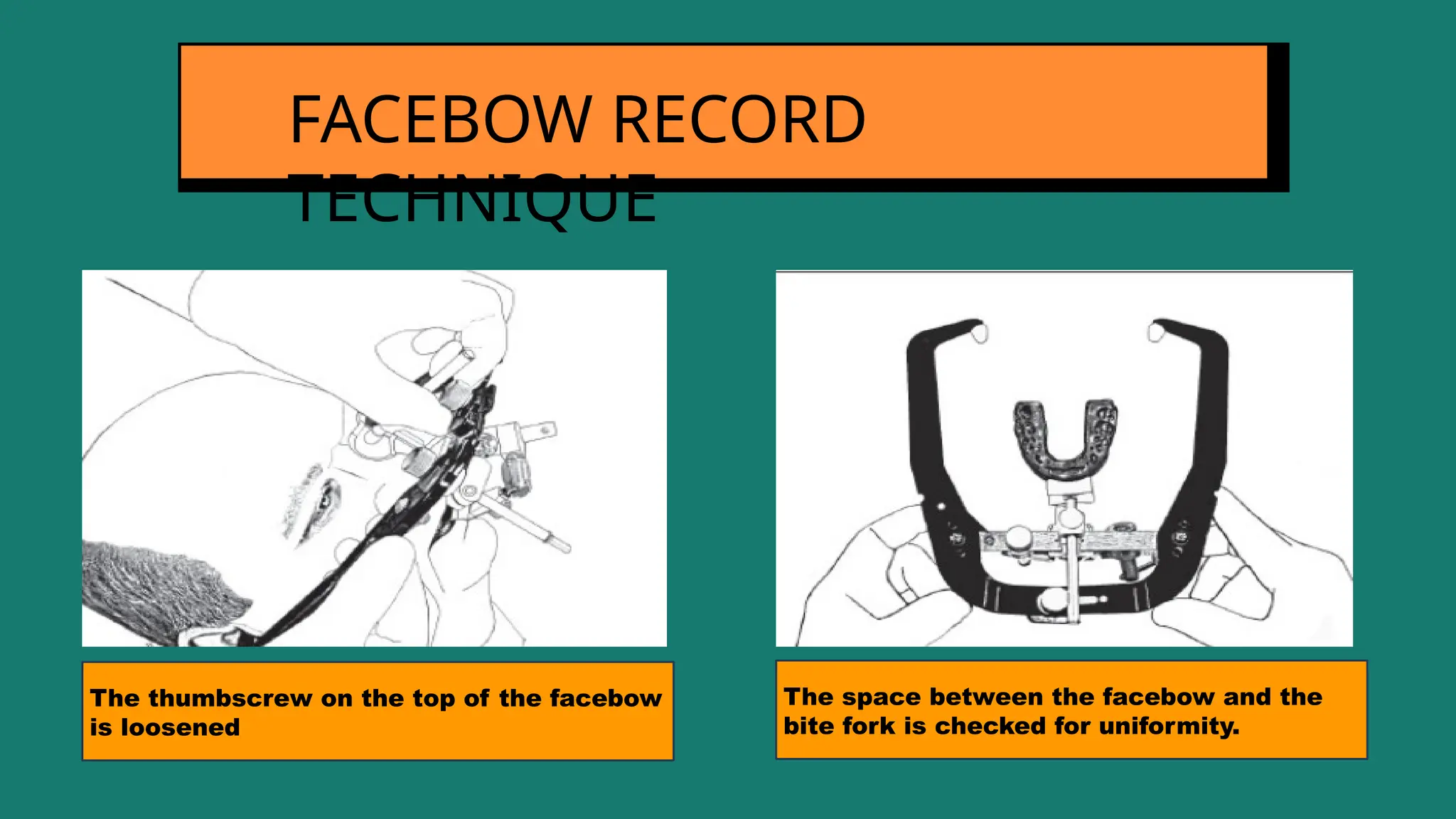 Facebow record, transfer and articulation | PPTX