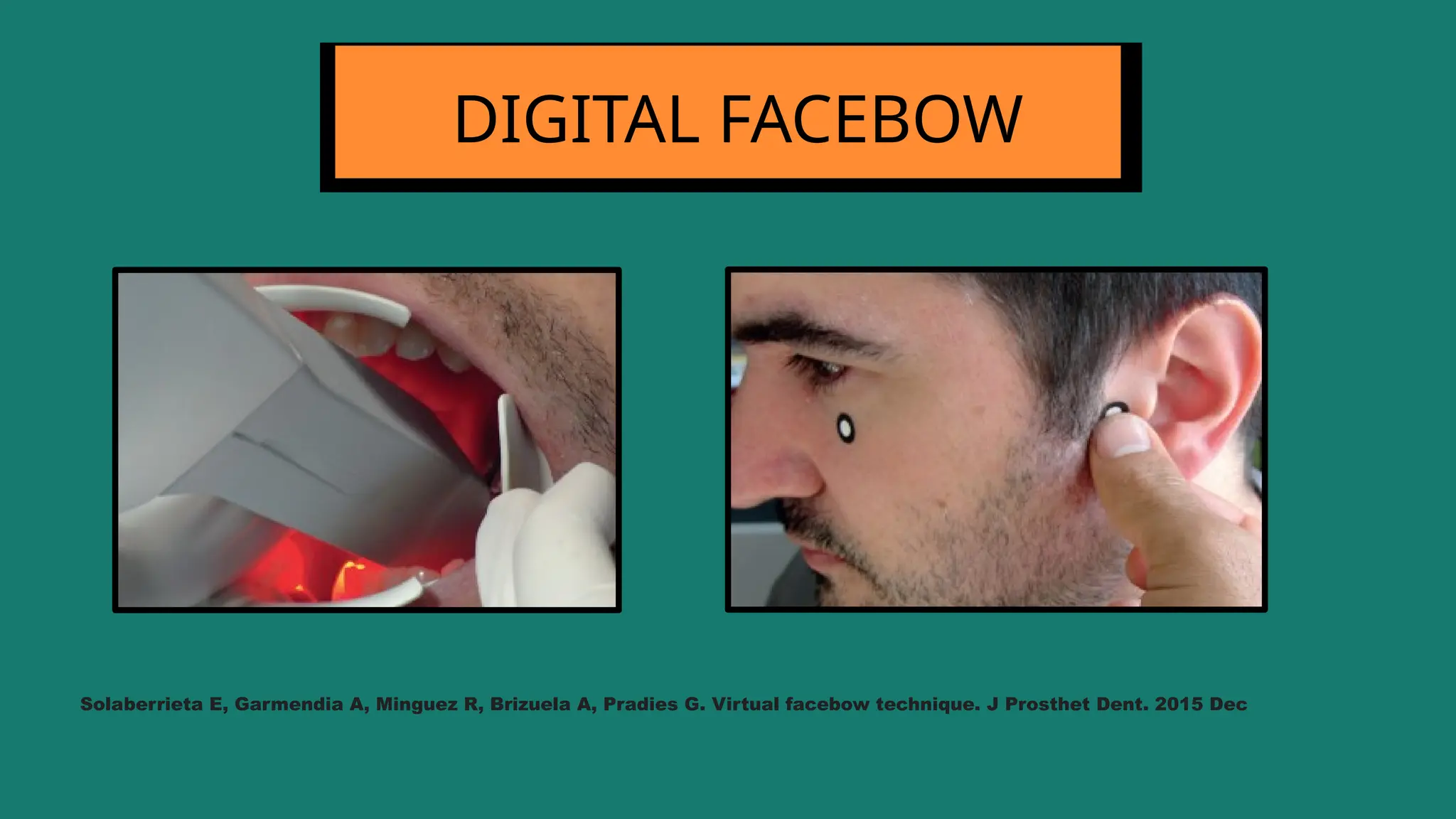 Facebow record, transfer and articulation | PPTX