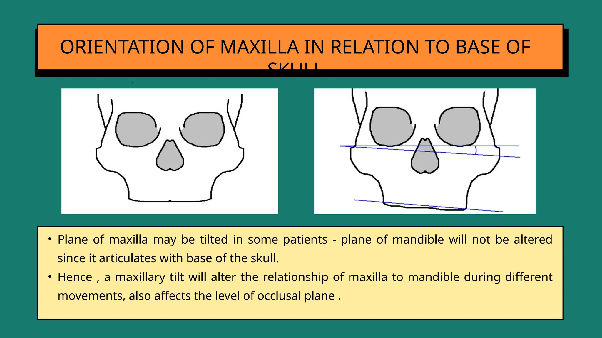 Facebow record, transfer and articulation | PPTX