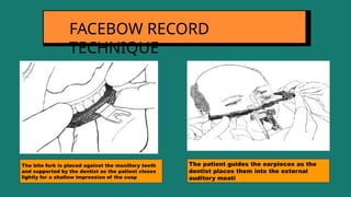 Facebow record, transfer and articulation | PPTX