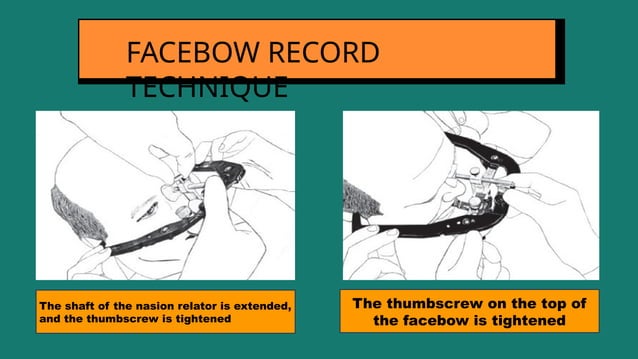 Facebow record, transfer and articulation | PPTX