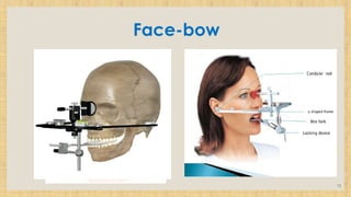 FACEBOW, types, procedures, importance of facebow in Complete dentures ...