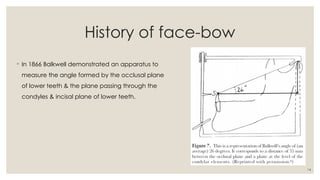 FACEBOW, types, procedures, importance of facebow in Complete dentures ...
