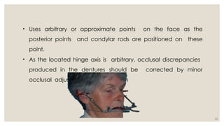 FACEBOW, types, procedures, importance of facebow in Complete dentures ...