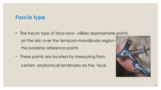 FACEBOW, types, procedures, importance of facebow in Complete dentures ...