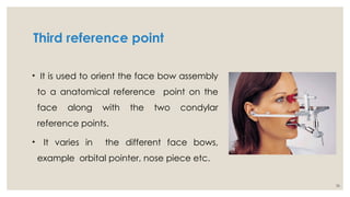 FACEBOW, types, procedures, importance of facebow in Complete dentures ...