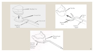 FACEBOW, types, procedures, importance of facebow in Complete dentures ...