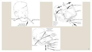 FACEBOW, types, procedures, importance of facebow in Complete dentures ...