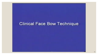 FACEBOW, types, procedures, importance of facebow in Complete dentures ...