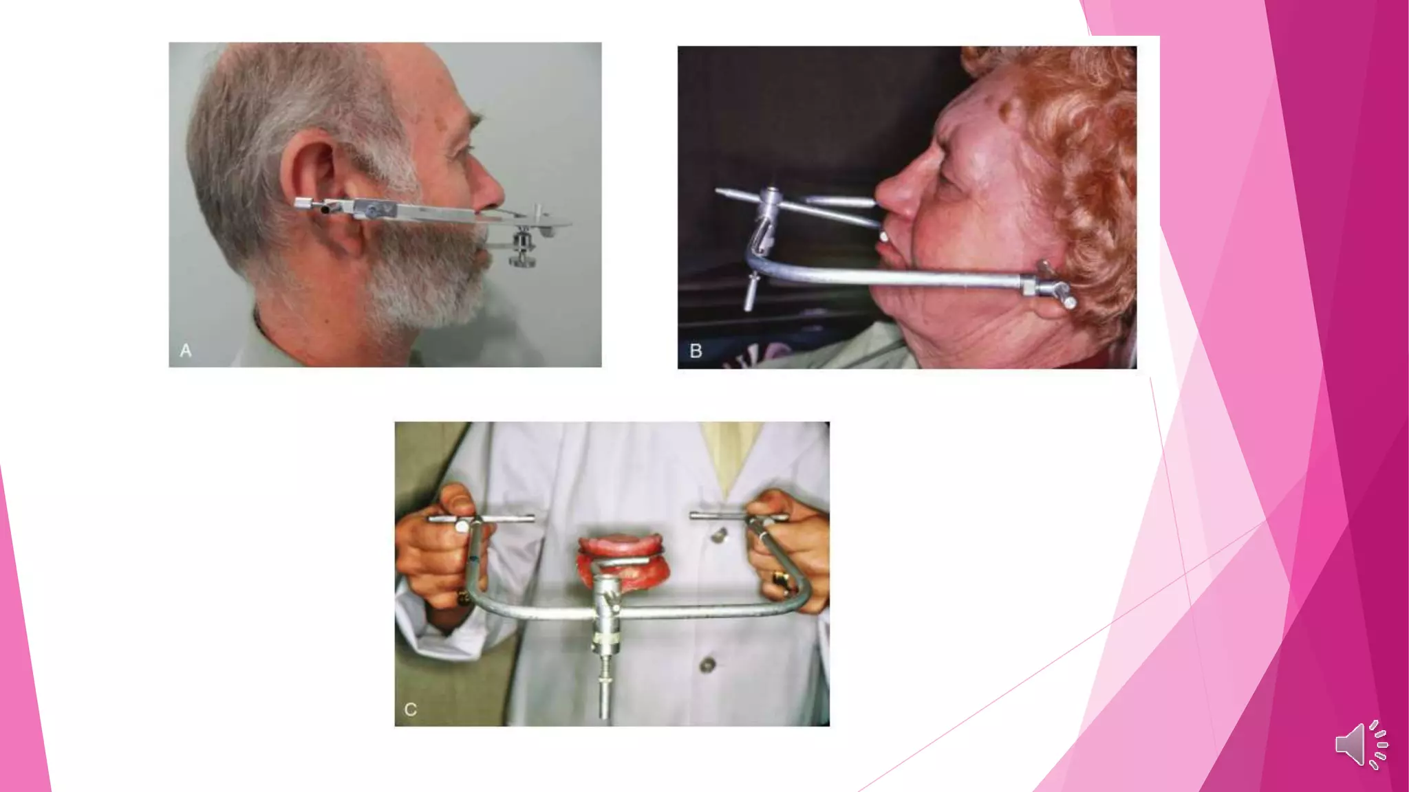 Introduction to Facebow | PPT