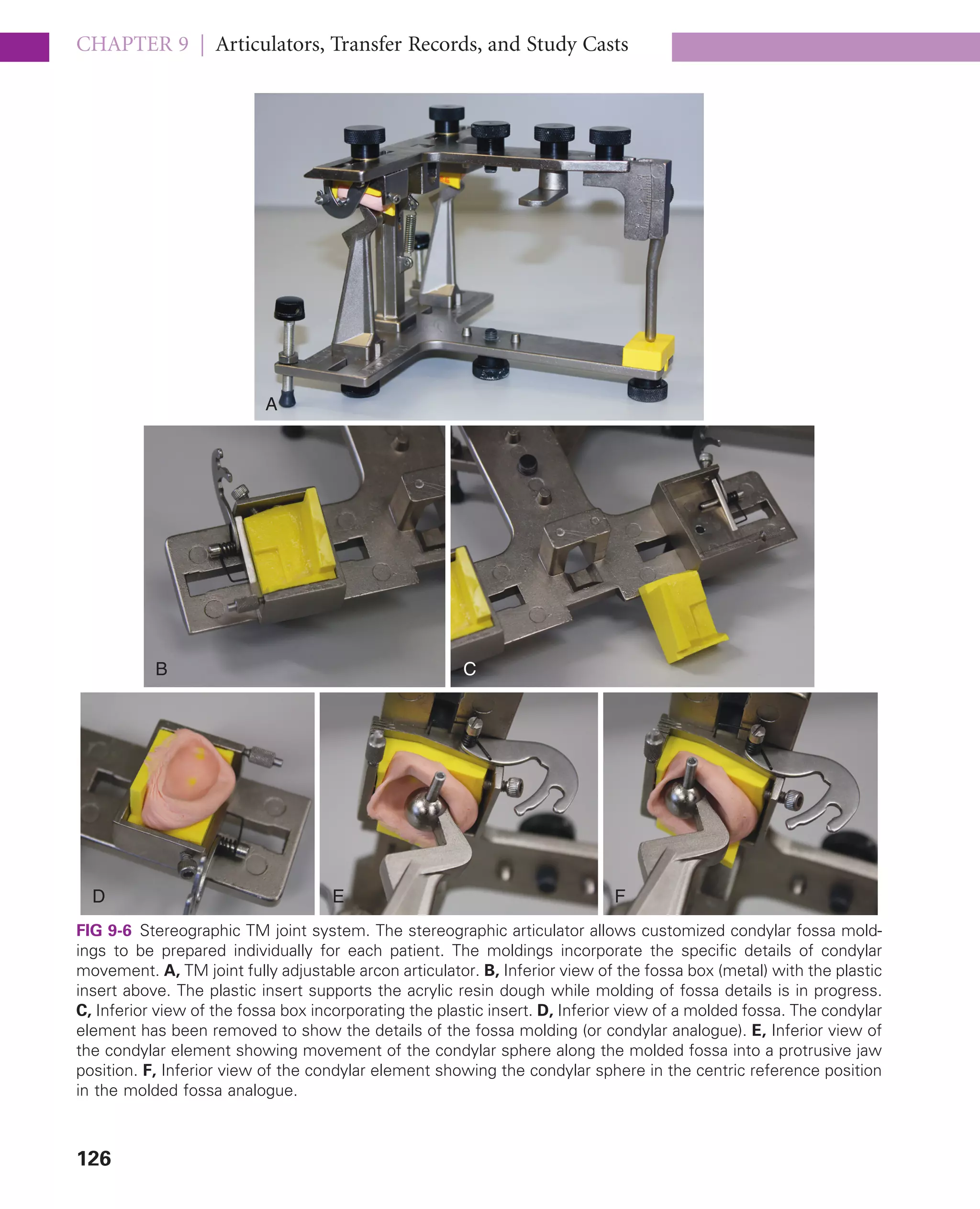 facebow and artoculator.pdf