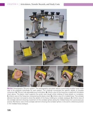 facebow and artoculator.pdf