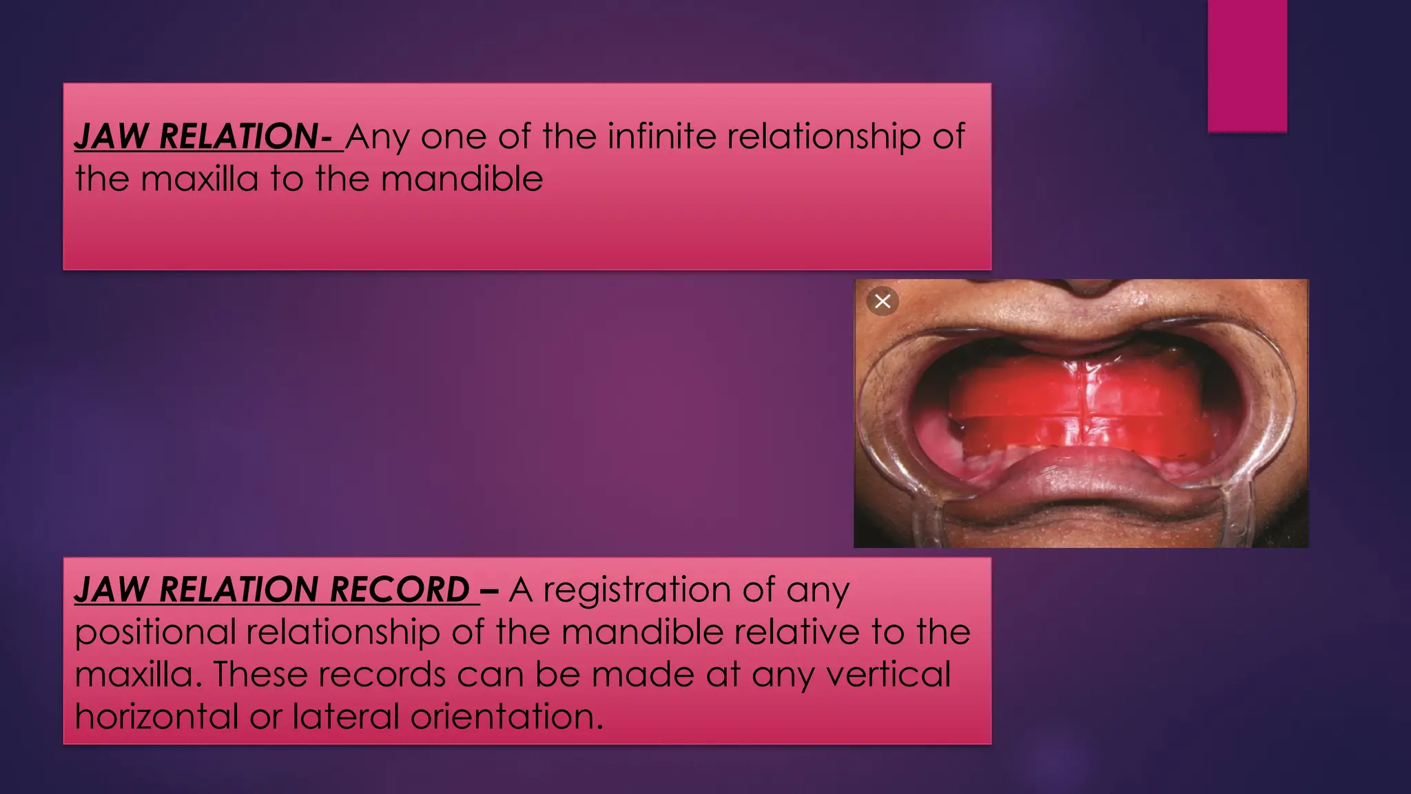FACE BOW uses in complete denture fabrication | PPTX