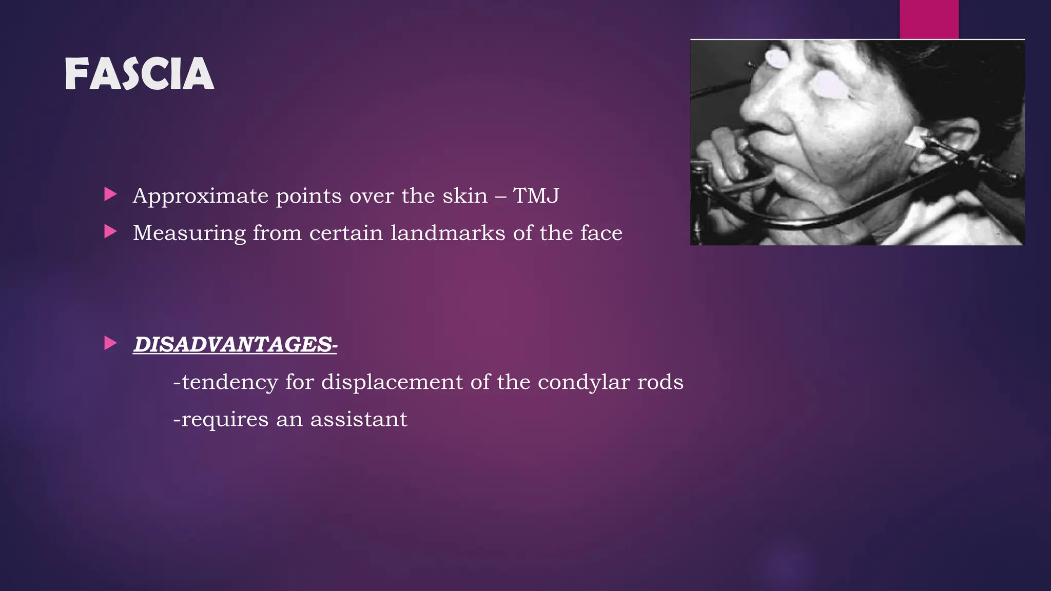 FACE BOW uses in complete denture fabrication | PPTX