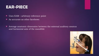 FACE BOW uses in complete denture fabrication | PPTX