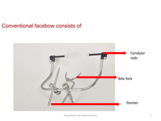 Digital Facebow an alternative in dentistry.pptx