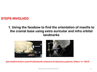 Digital Facebow an alternative in dentistry.pptx