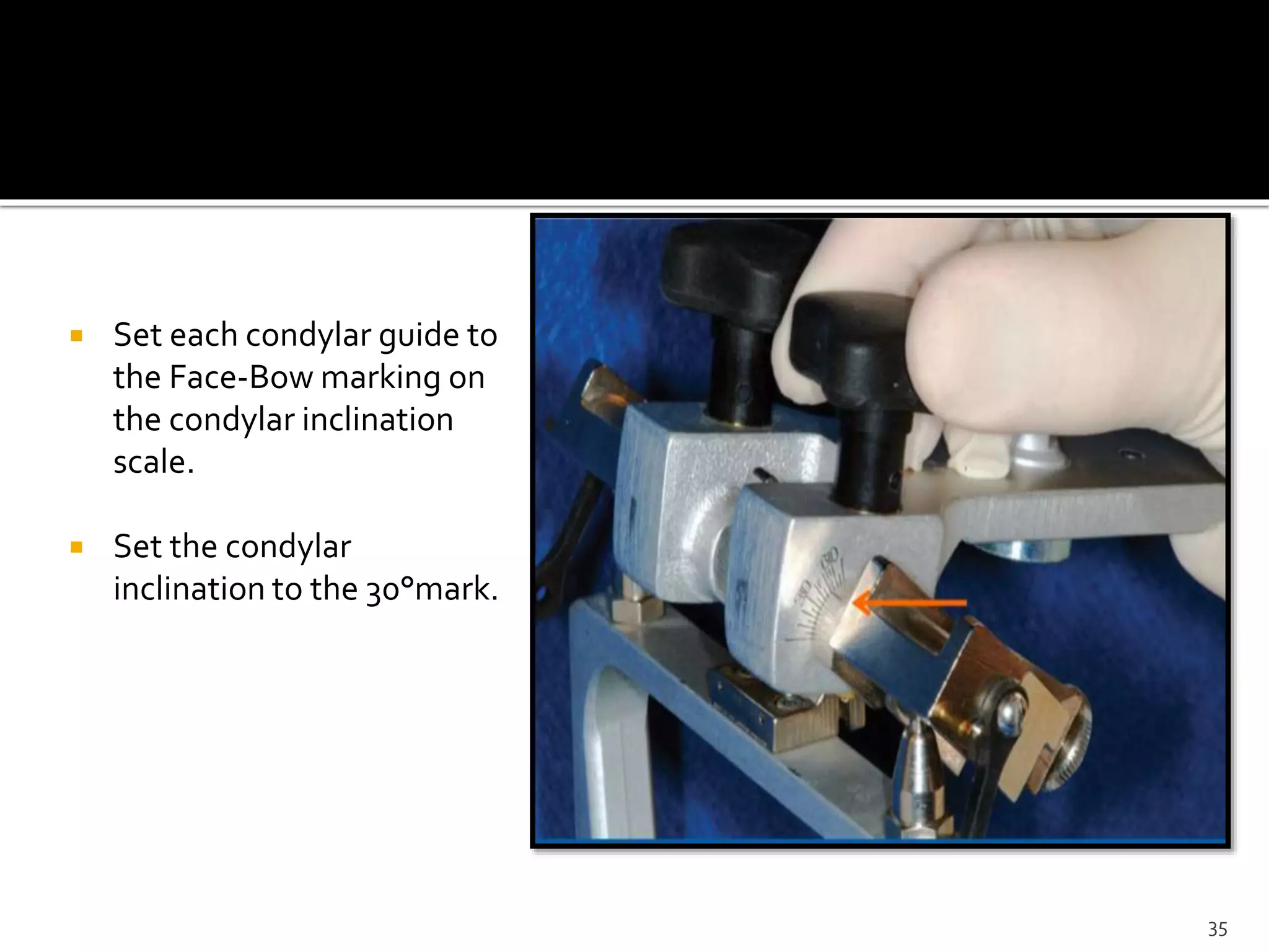 Facebow part ii | PPTX