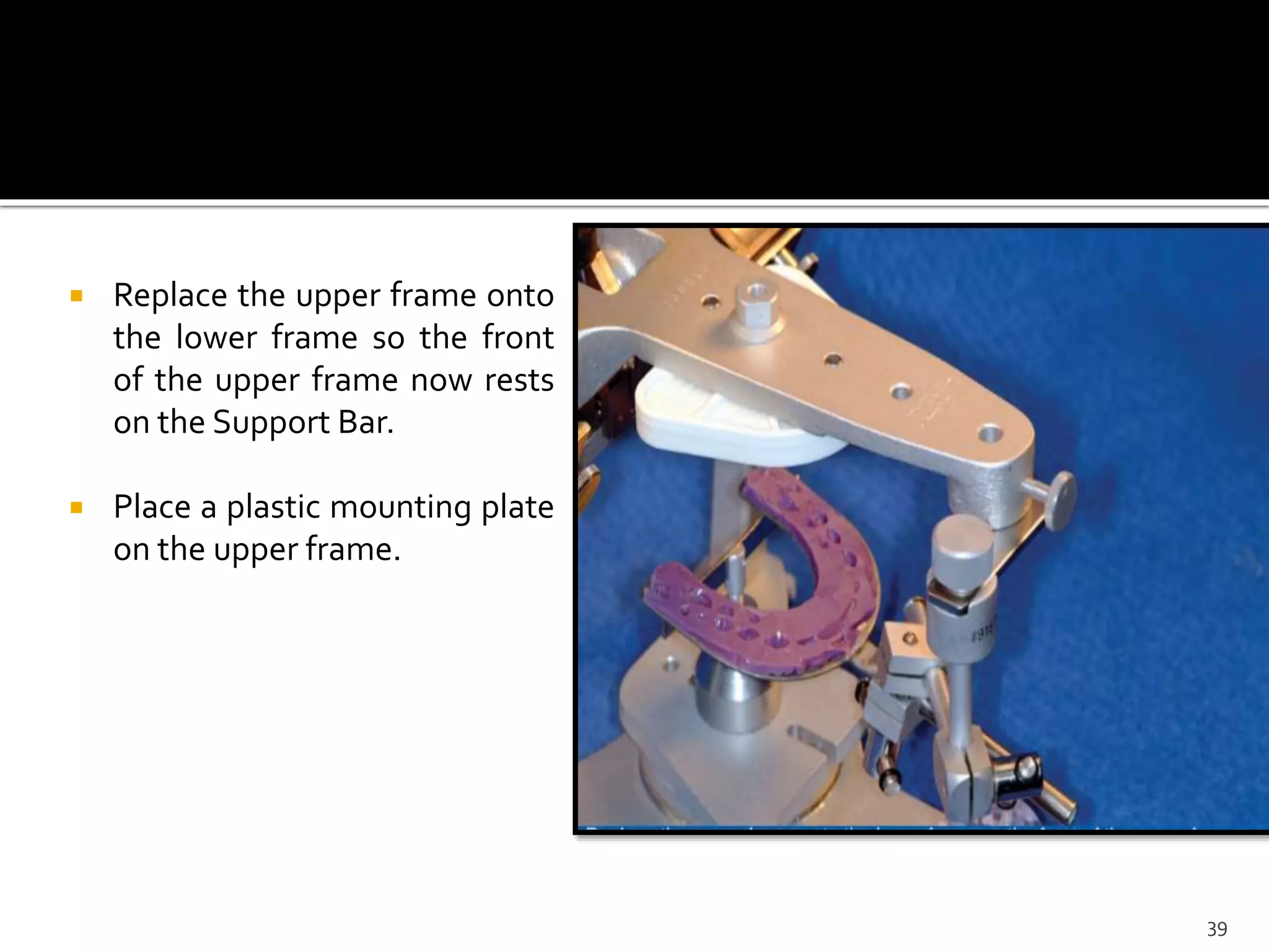Facebow part ii | PPTX
