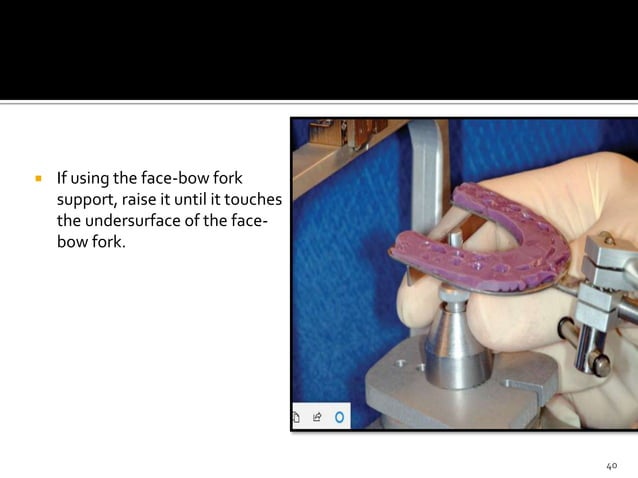 Facebow part ii | PPTX