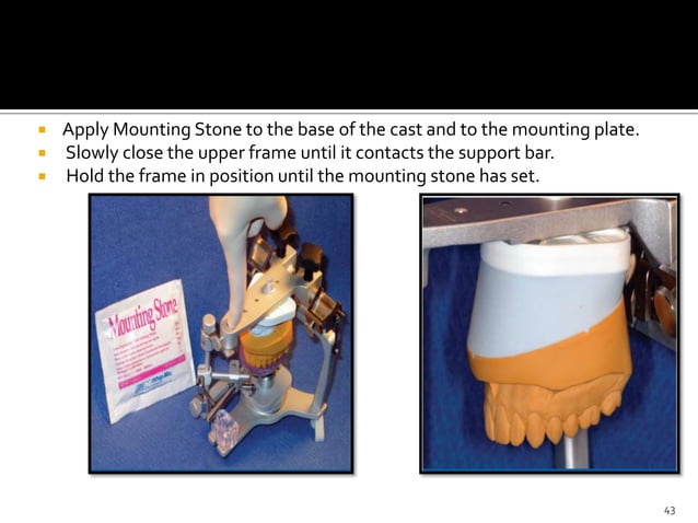 Facebow part ii | PPTX