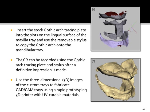 Facebow part ii | PPTX