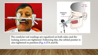 FACE BOW (SEMI 5).pptx