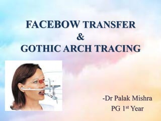 Facebow transfer | PPTX