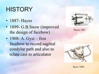 Facebow transfer | PPTX