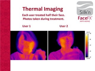 Silk'n Face FX for skin rejuvenation | PPT