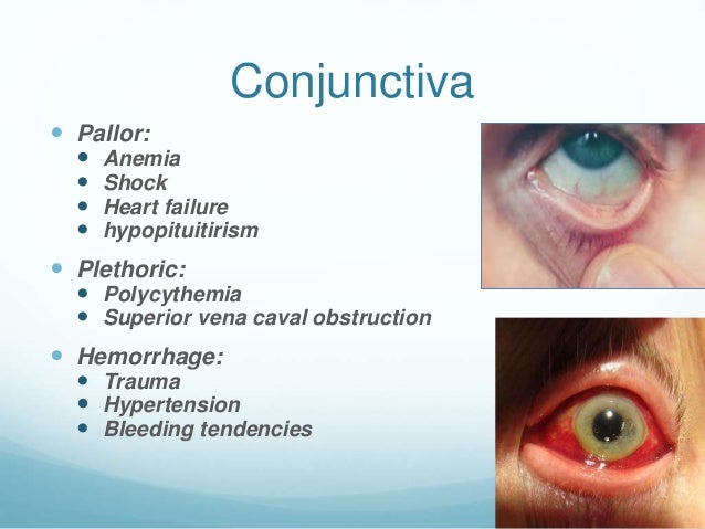 Face general examination