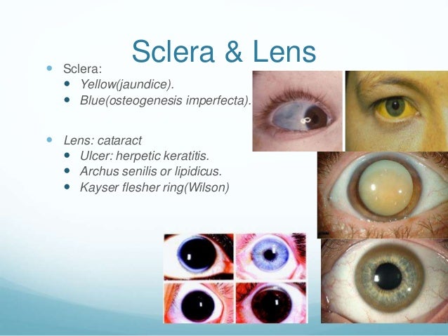 Face general examination