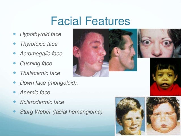 Face general examination